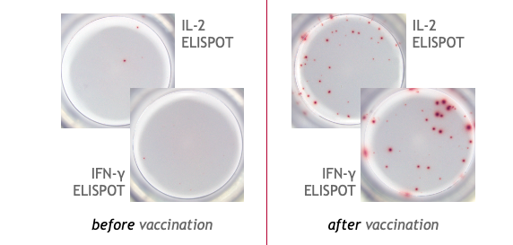 T cell ELISPOT assay | U-CyTech